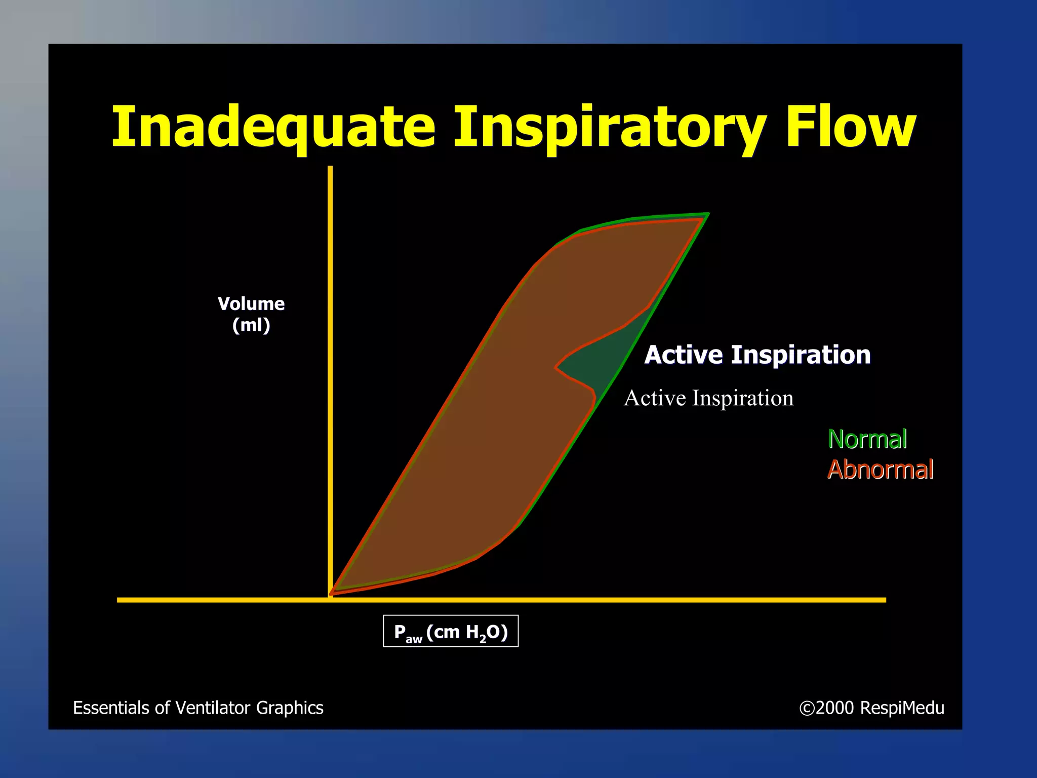 ventilator waveforms Dr Sanjay Chugh.pptx