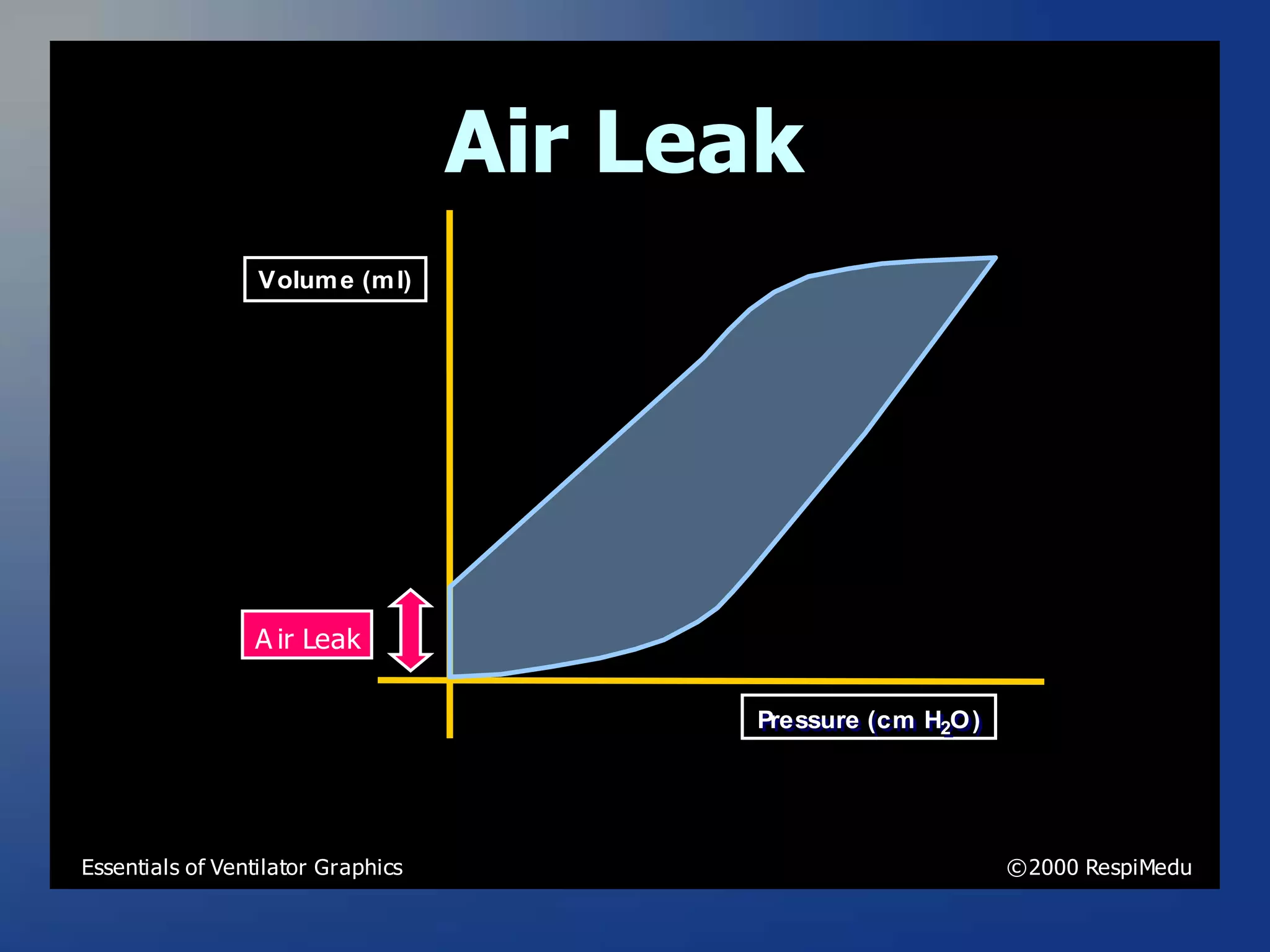 ventilator waveforms Dr Sanjay Chugh.pptx