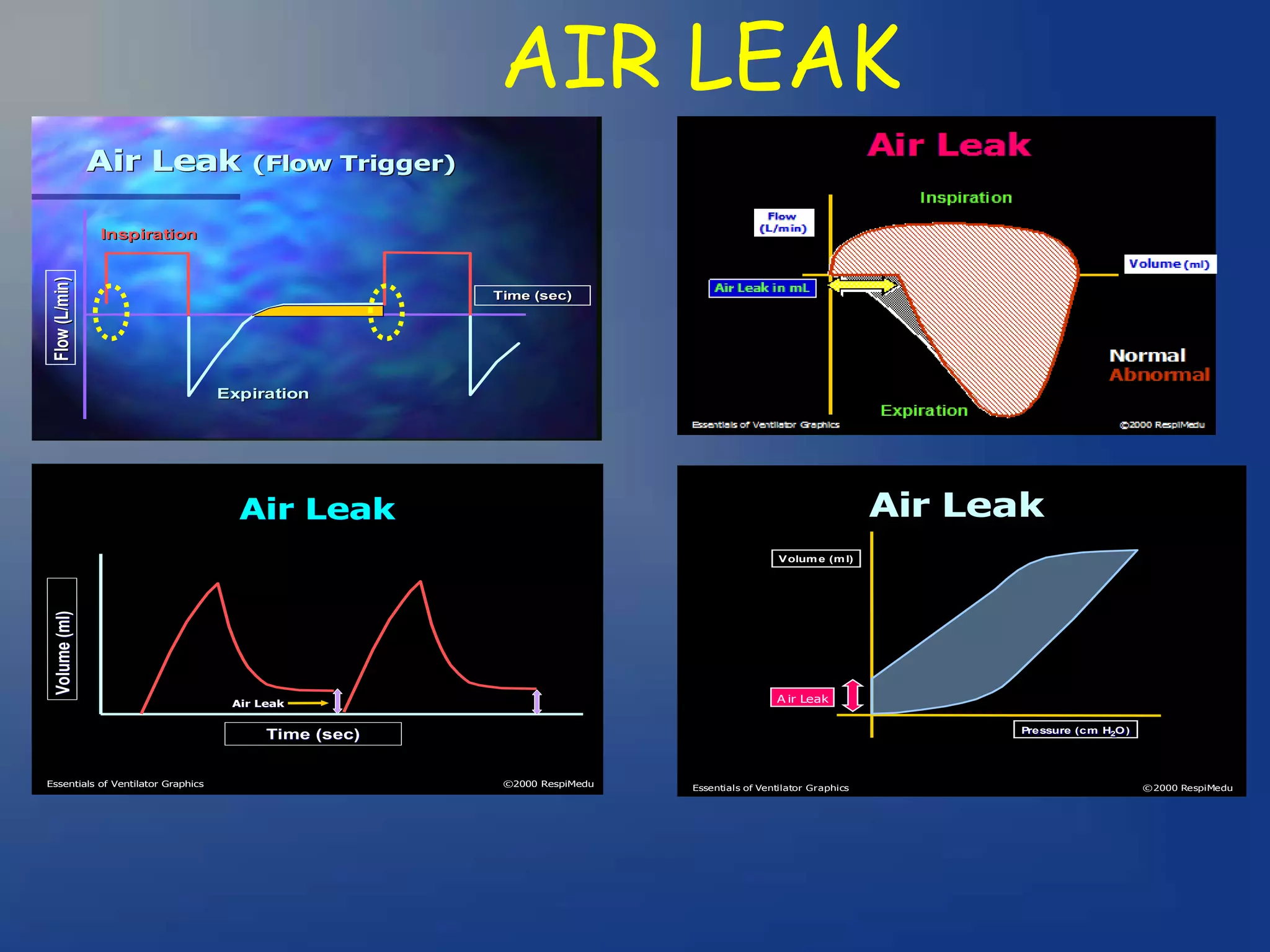 ventilator waveforms Dr Sanjay Chugh.pptx