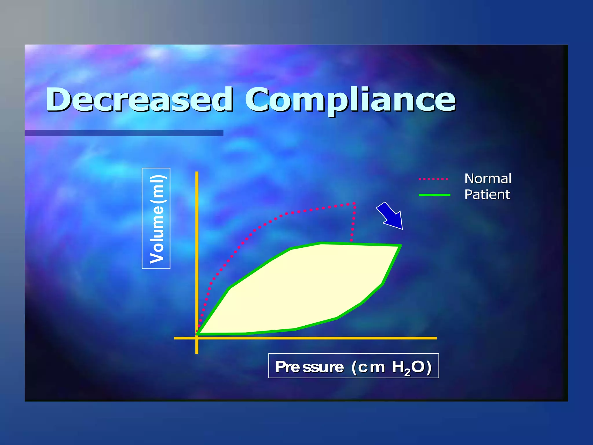 ventilator waveforms Dr Sanjay Chugh.pptx