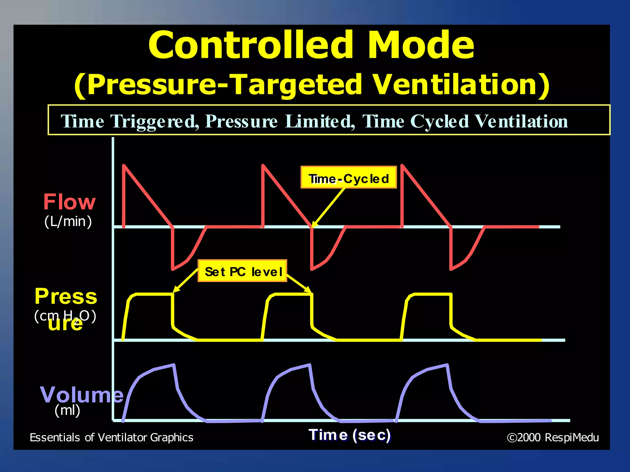 ventilator waveforms Dr Sanjay Chugh.pptx