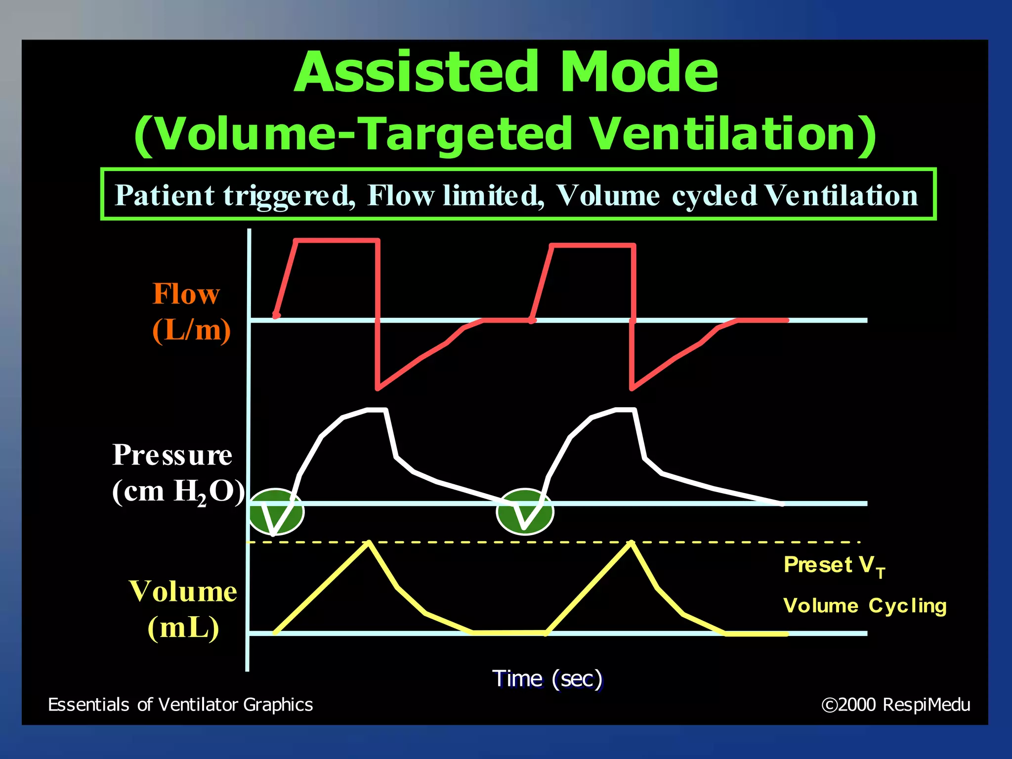 ventilator waveforms Dr Sanjay Chugh.pptx