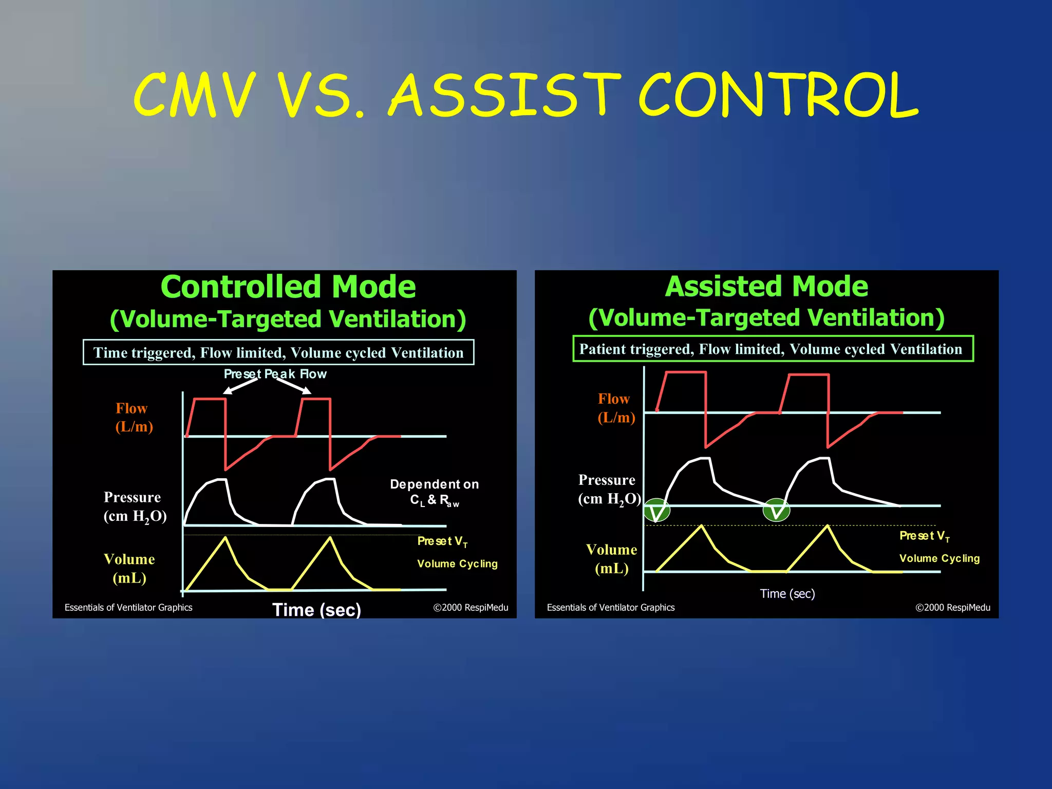 ventilator waveforms Dr Sanjay Chugh.pptx