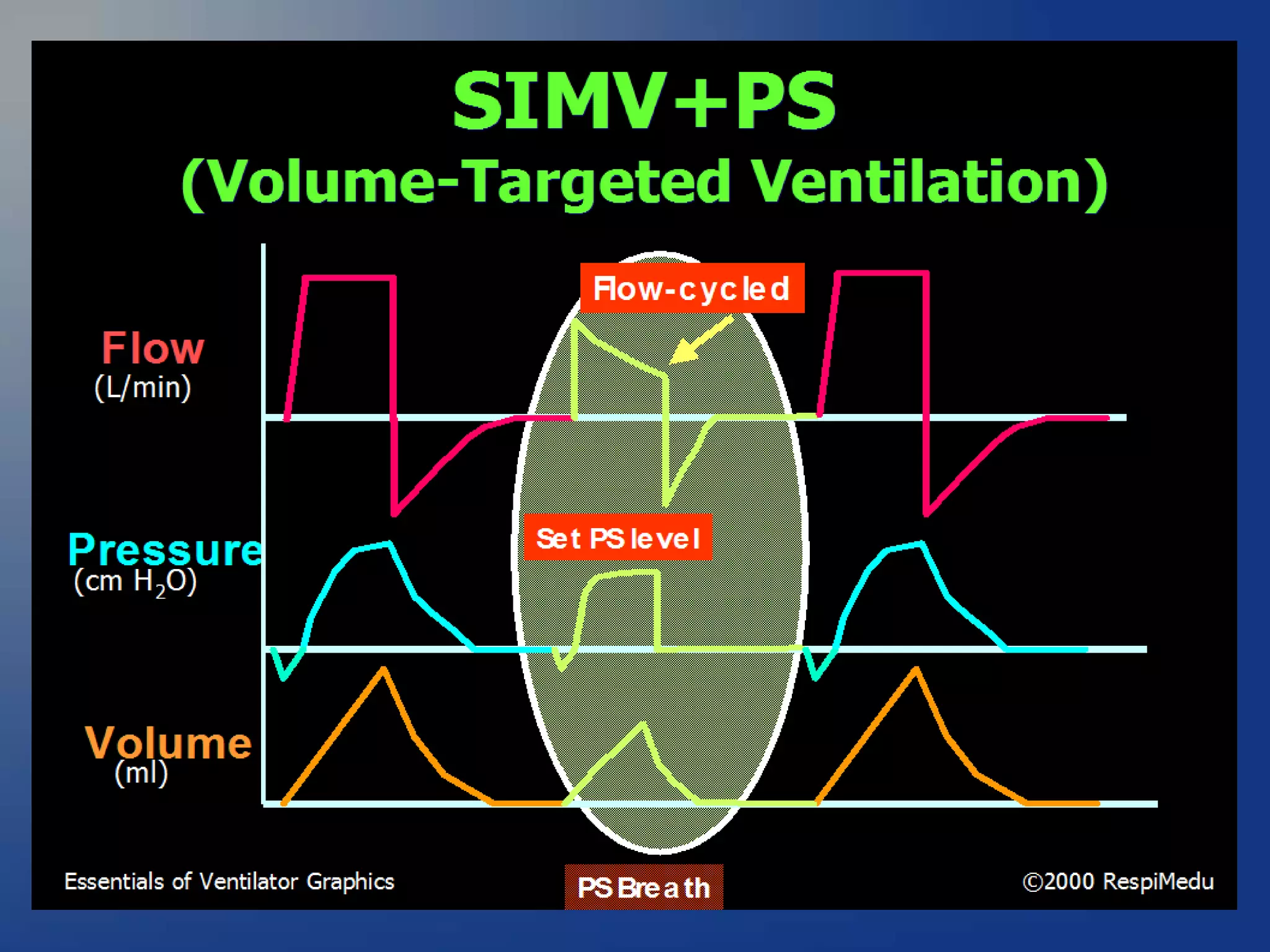 ventilator waveforms Dr Sanjay Chugh.pptx