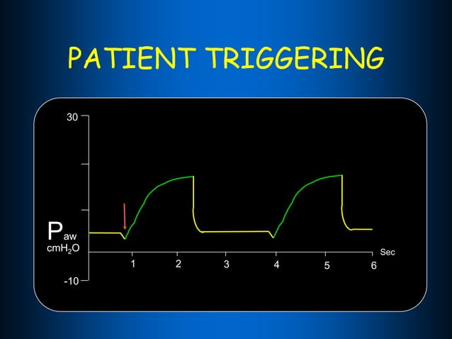 ventilator waveforms Dr Sanjay Chugh.pptx | Lung and Respiratory Health ...