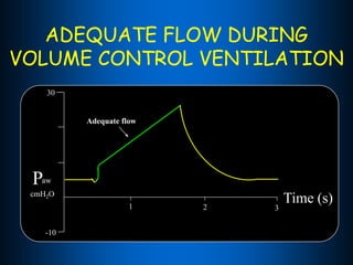 ventilator waveforms Dr Sanjay Chugh.pptx