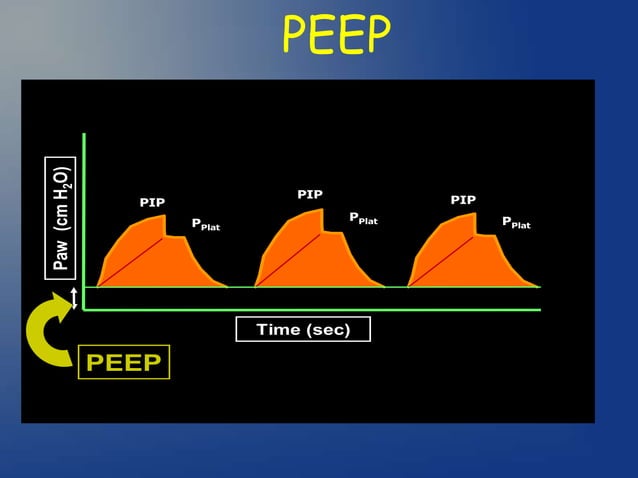 ventilator waveforms Dr Sanjay Chugh.pptx | Lung and Respiratory Health ...