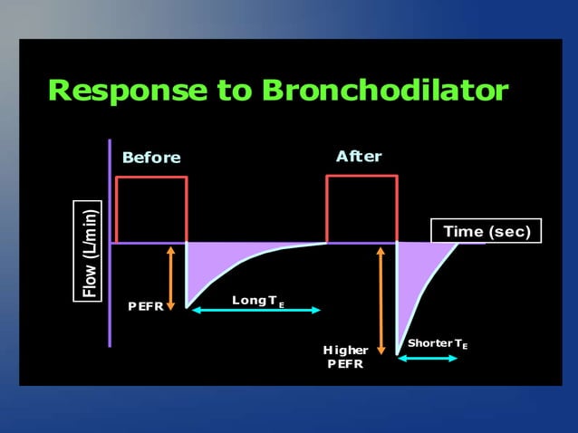 Ventilator Waveforms Dr Sanjay Chugh Pptx