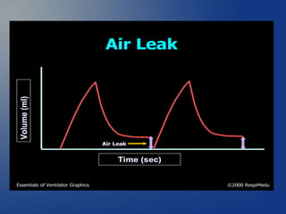 ventilator waveforms Dr Sanjay Chugh.pptx