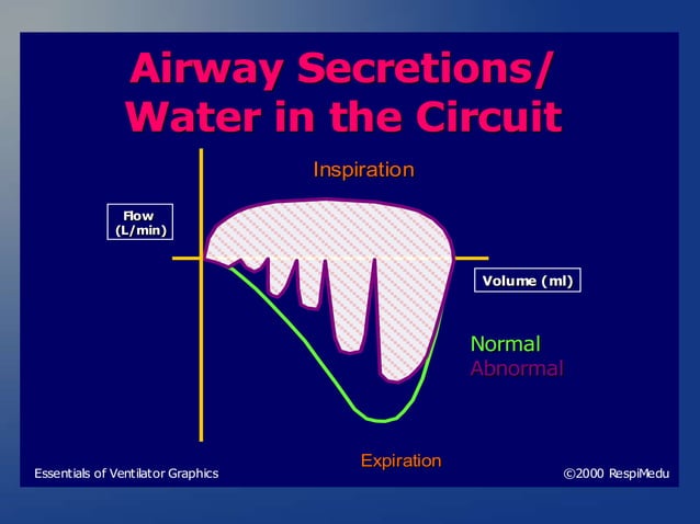 ventilator waveforms Dr Sanjay Chugh.pptx | Lung and Respiratory Health ...