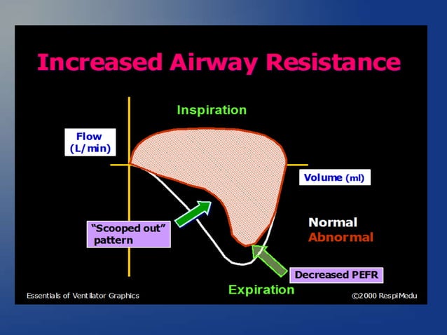 ventilator waveforms Dr Sanjay Chugh.pptx | Lung and Respiratory Health ...