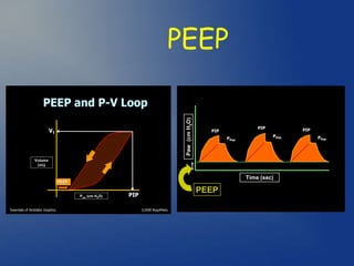 ventilator waveforms Dr Sanjay Chugh.pptx