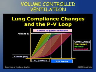 ventilator waveforms Dr Sanjay Chugh.pptx