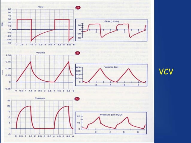 ventilator waveforms Dr Sanjay Chugh.pptx | Lung and Respiratory Health ...