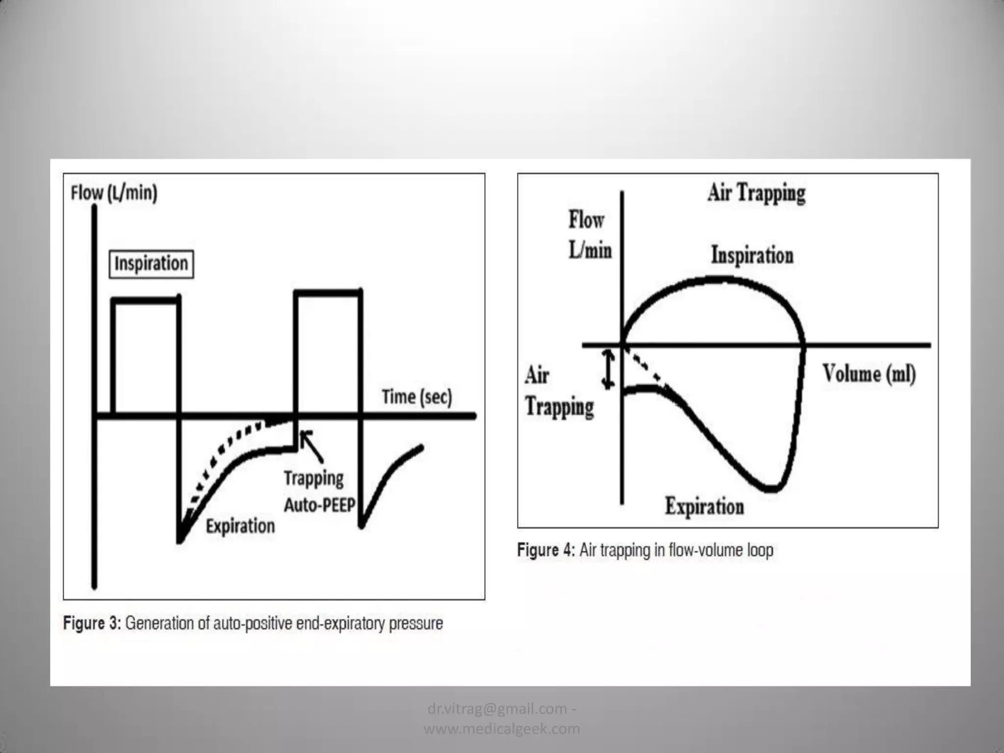 Ventilatory management in obstructive airway diseases | PDF