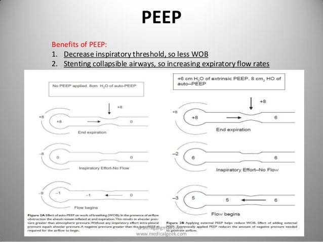 Ventilatory management in obstructive airway diseases