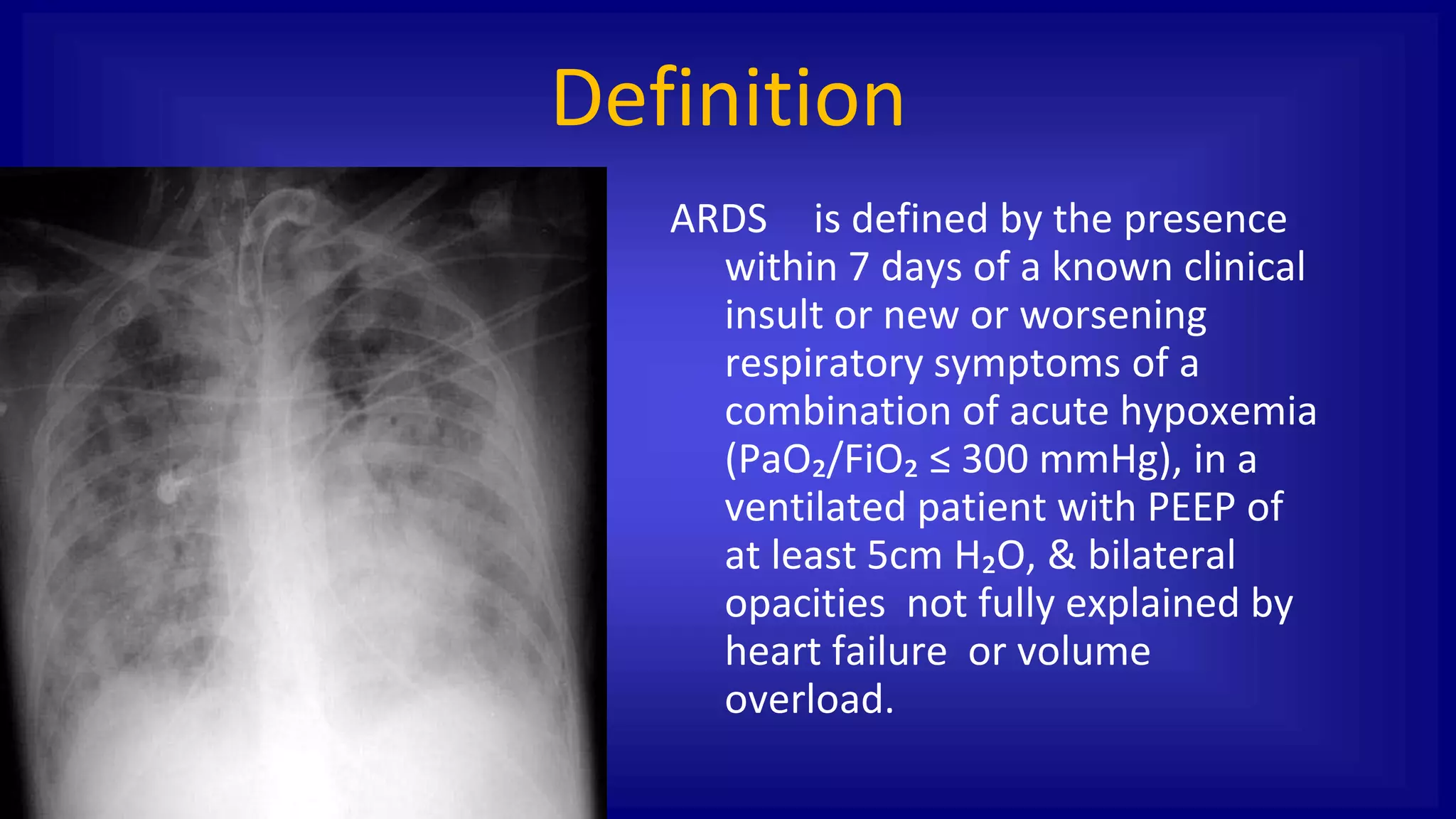 Ventilotry managemant of ards | PPTX