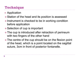 Ventouse delivery | PPTX