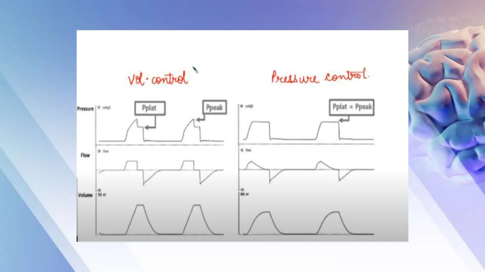 Mechanical ventilation to understand basics of mechanical ventilation ...