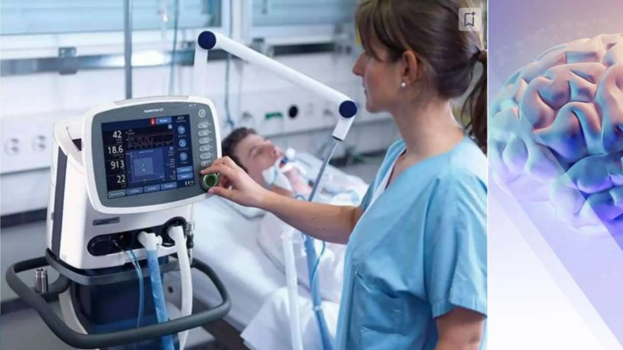 Mechanical ventilation to understand basics of mechanical ventilation ...
