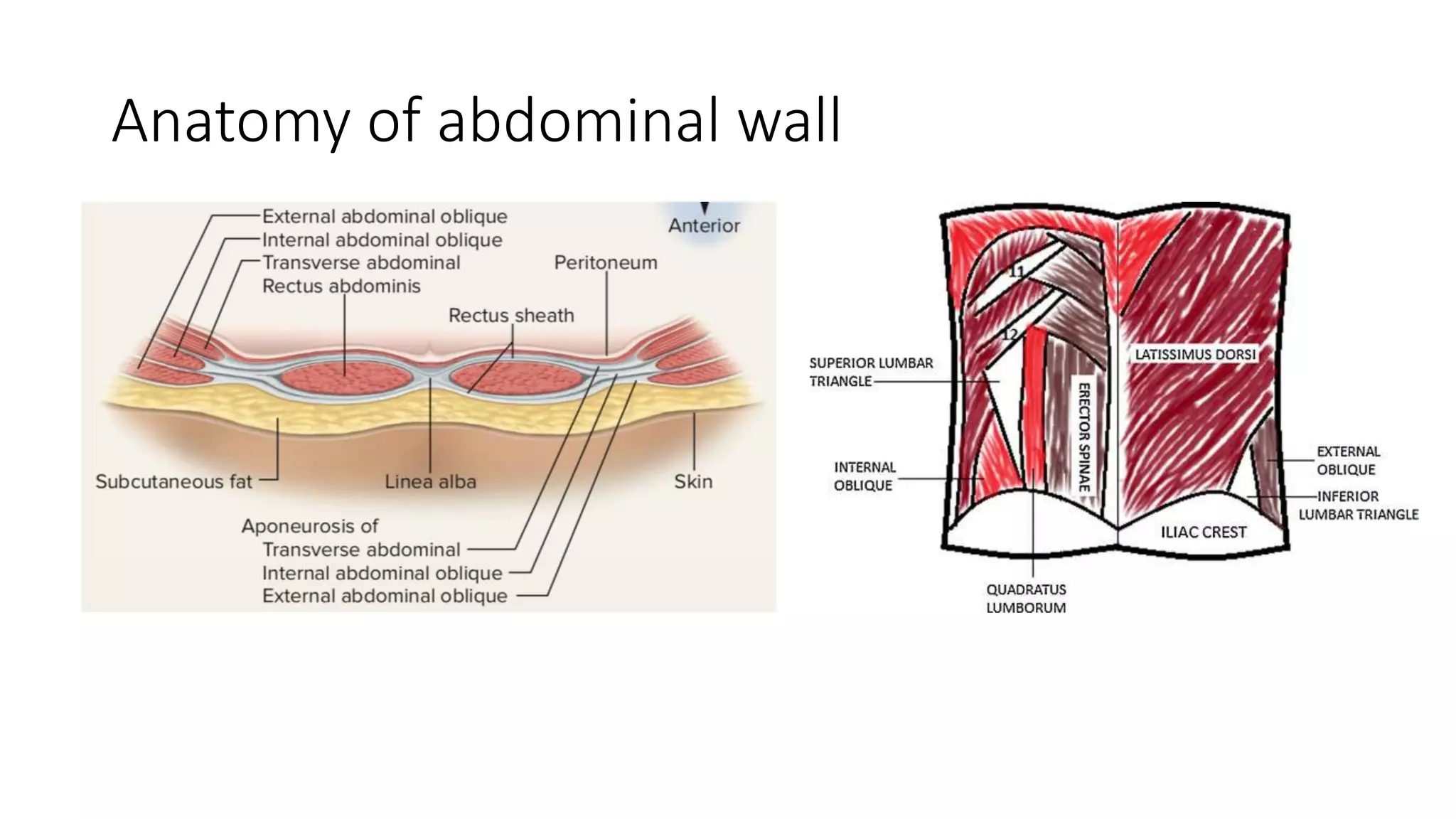 VENTRAL AND GROIN HERNIA BSc 3.pptx