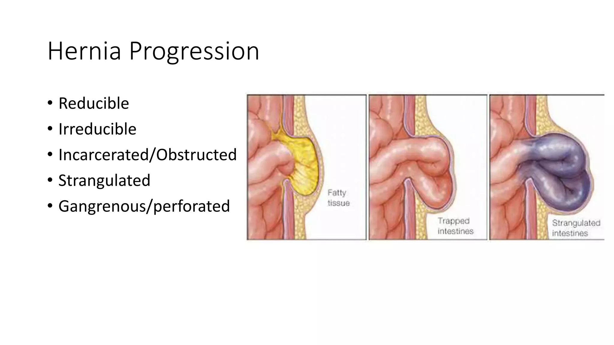 VENTRAL AND GROIN HERNIA BSc 3.pptx