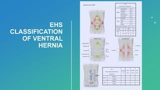 Ventral and incisional hernias and management.pptx