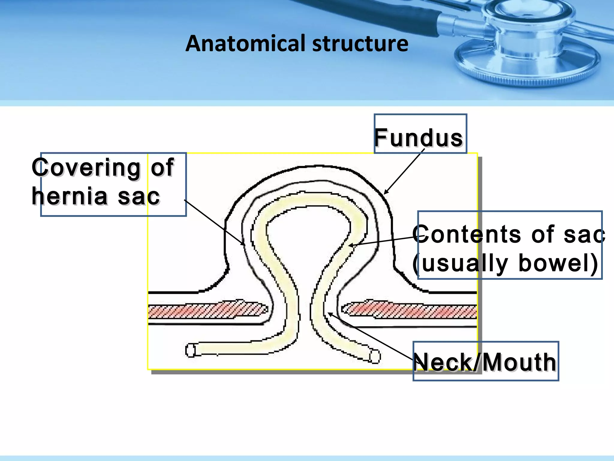 Ventral hernia by Dr Teo | PPT