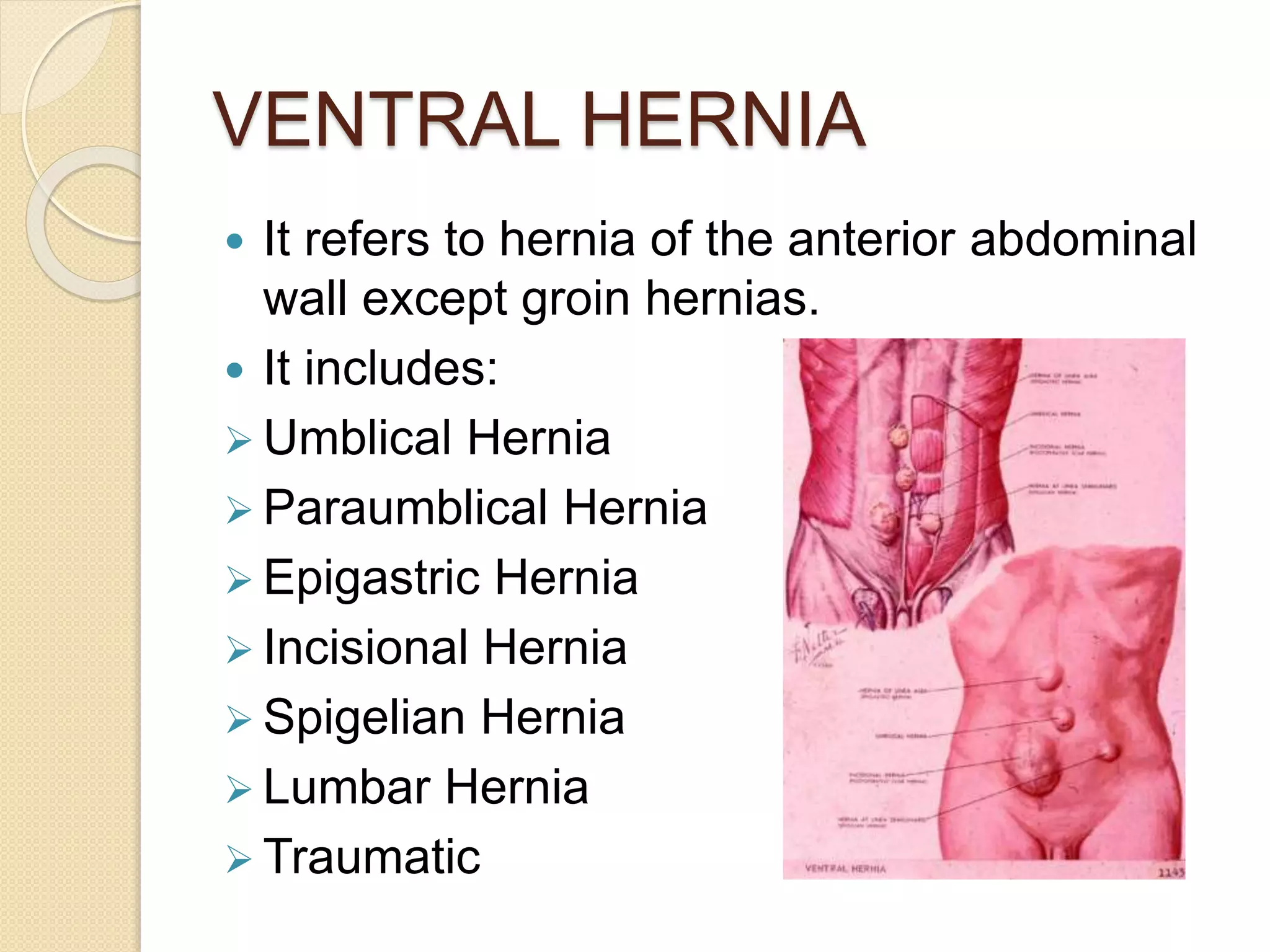 VENTRAL HERNIA.pptx | Pregnancy | Reproductive Health