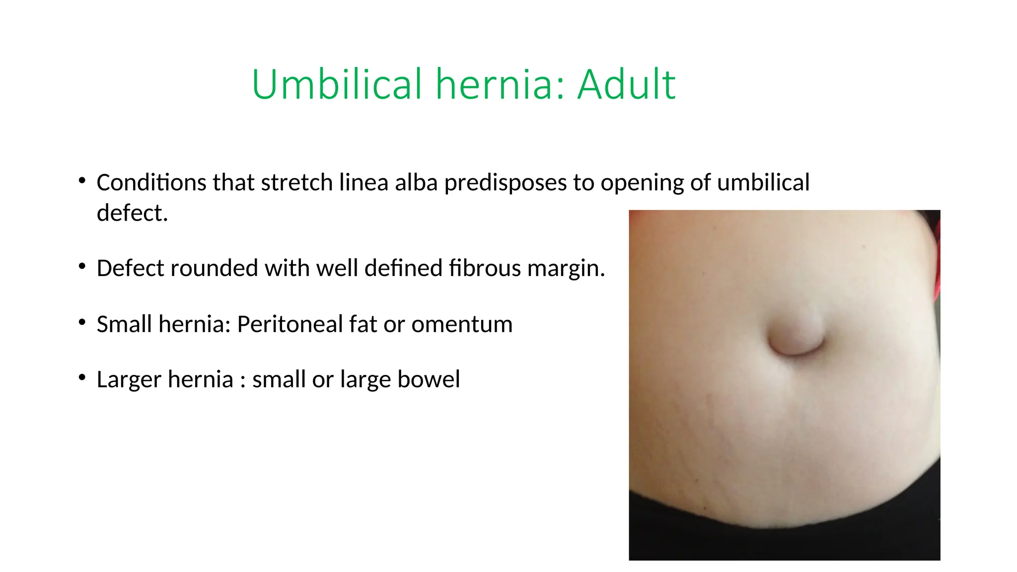 VENTRAL HERNIA - Abdominal Wall Reconstruction AWR - Surgery -Repair ...