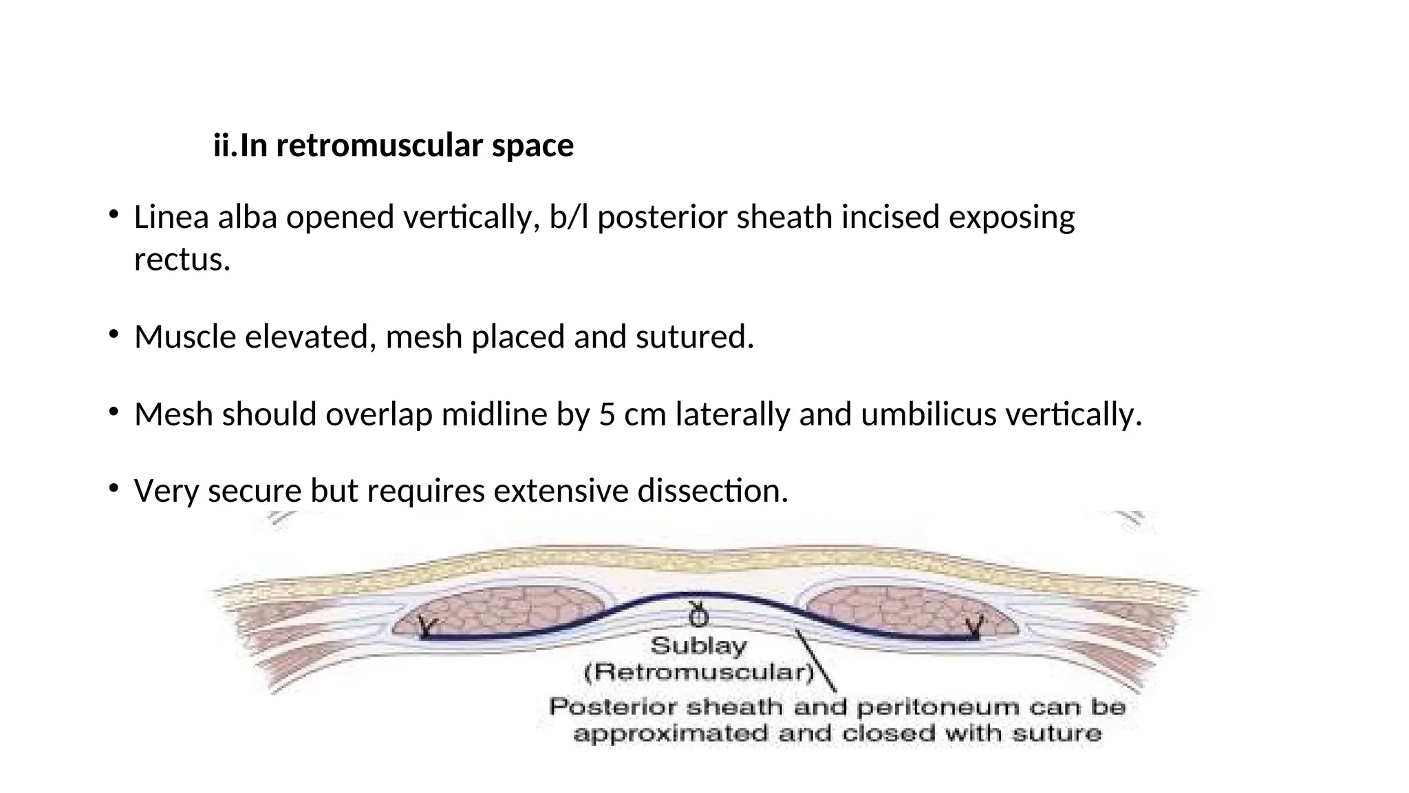 VENTRAL HERNIA - Abdominal Wall Reconstruction AWR - Surgery -Repair ...