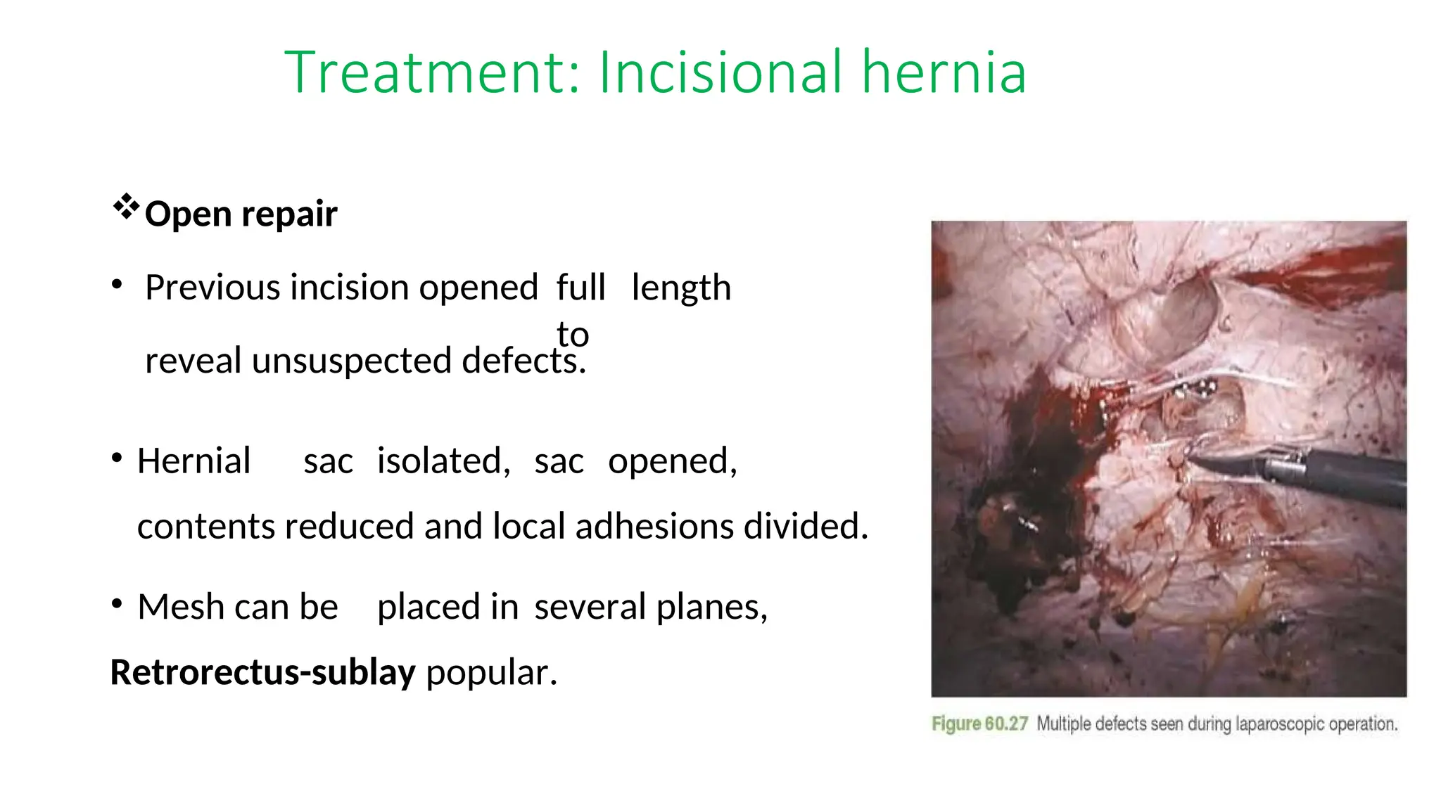 VENTRAL HERNIA - Abdominal Wall Reconstruction AWR - Surgery -Repair ...