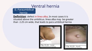 VENTRAL HERNIA GROUP 1 SECTION SURGERY.pptx
