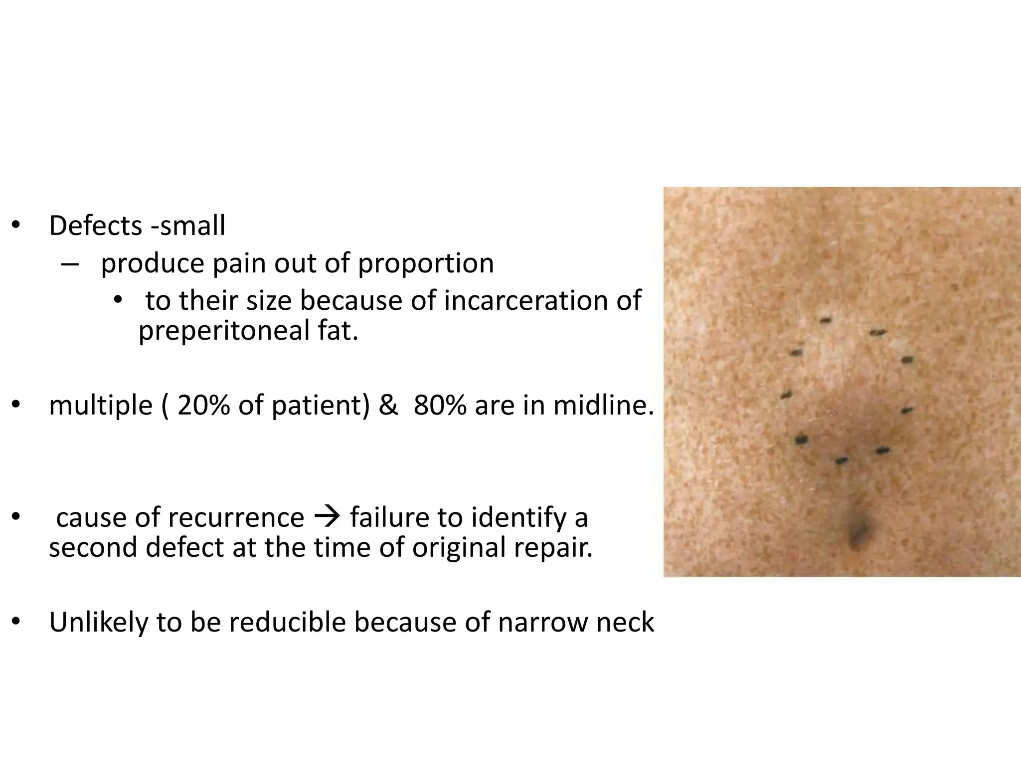 Ventral hernia inguinal hernia anterior abdominal wall .pptx