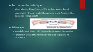 Ventral hernia management | PPTX
