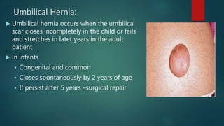 Ventral hernia management | PPTX