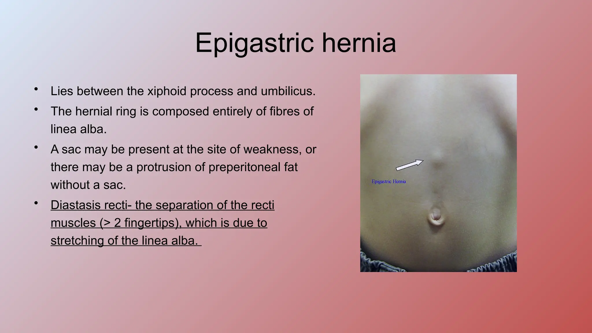 ventral hernia repair-DEPARTMENT OF GENERAL SURGERY | PPTX