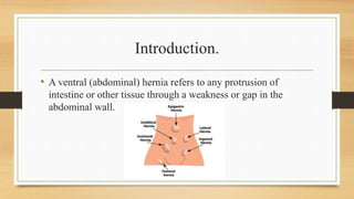 Ventral Hernias.pptx