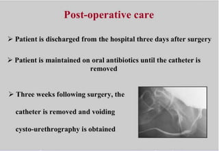 Ventral oral mucosal onlay graft urethroplasty | PPT