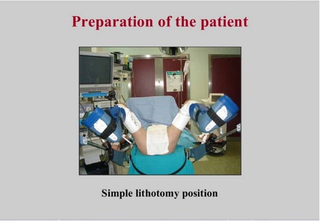 Ventral oral mucosal onlay graft urethroplasty | PPT | Free Download