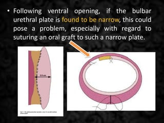 Ventral vs dorsalfinal | PPT