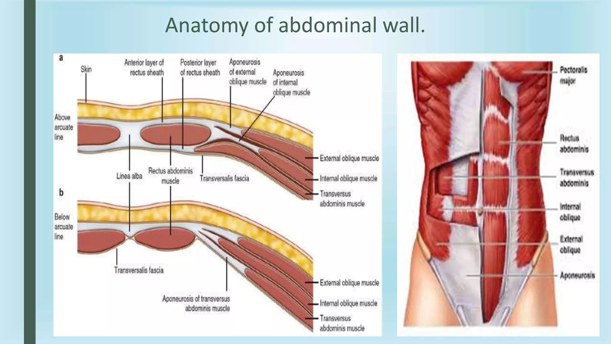 VENTRAL WALL HERNIA.pptx