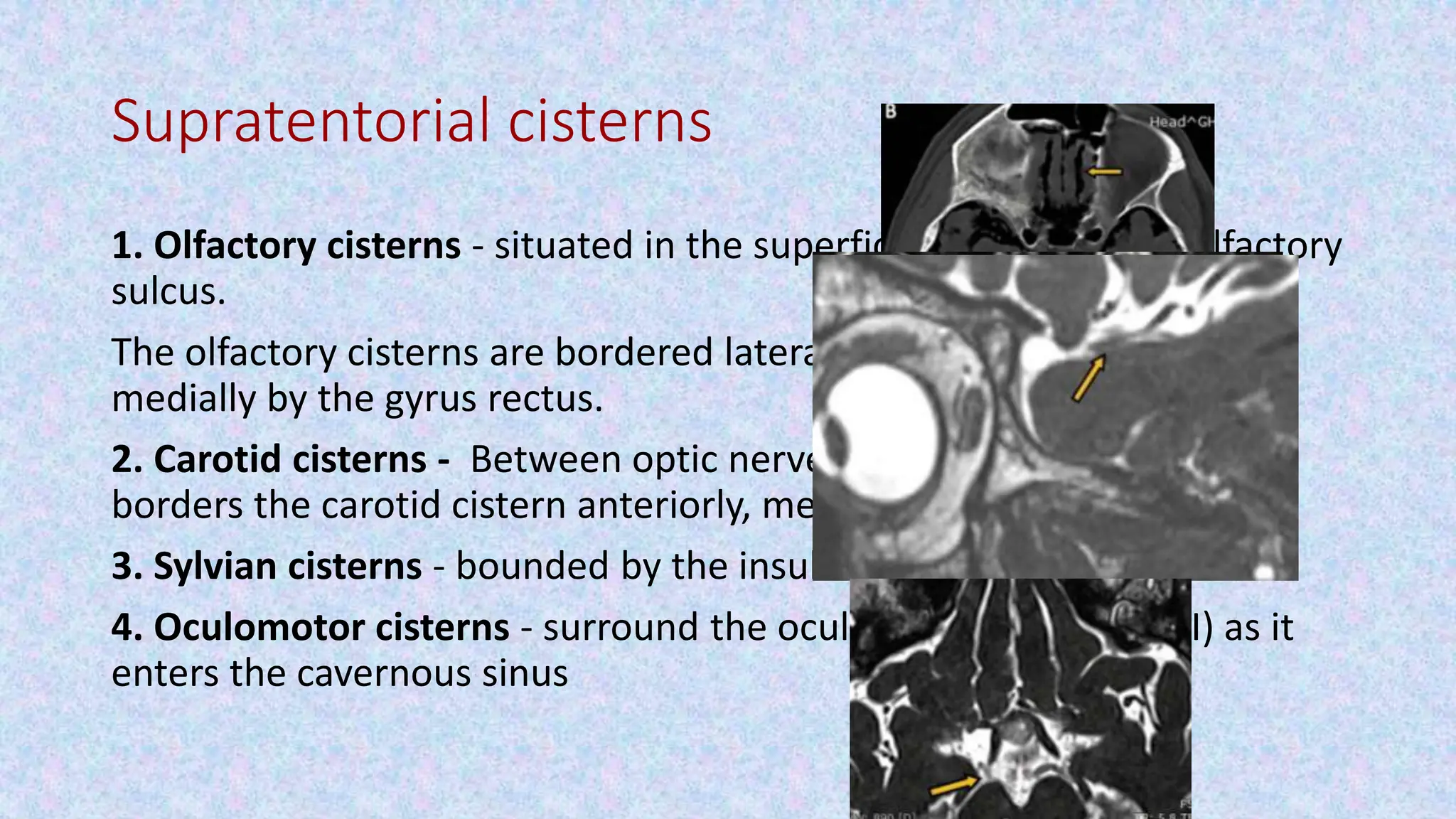 VENTRICLES AND CISTERNS OF HUMAN BRAIN.pptx