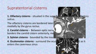 VENTRICLES AND CISTERNS OF HUMAN BRAIN.pptx