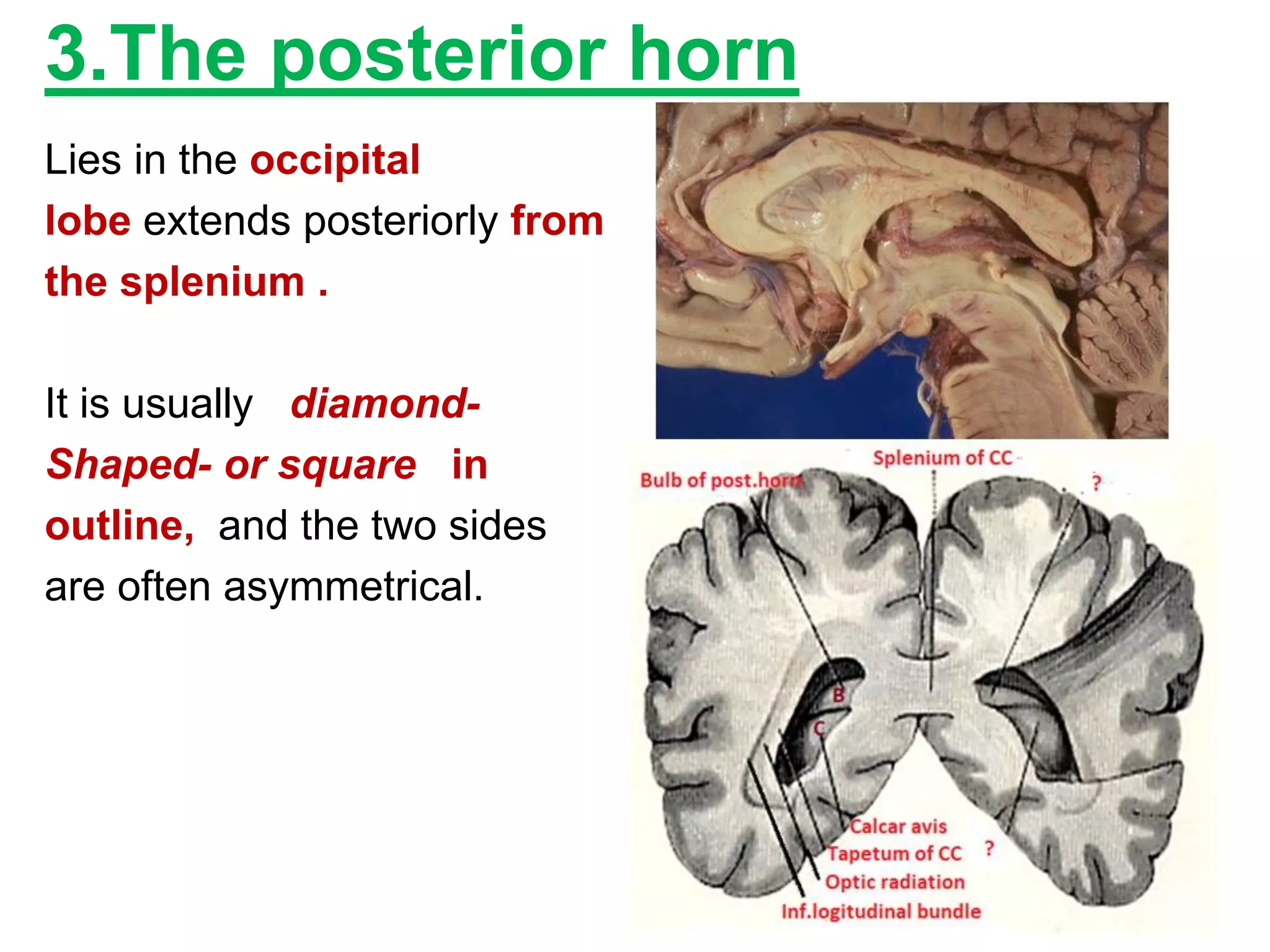 Ventricles of the brain | PDF