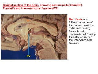 Interventricular Septum Brain