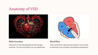 Ventricular-Septal-Defect-A-Comprehensive-Overview.pdf