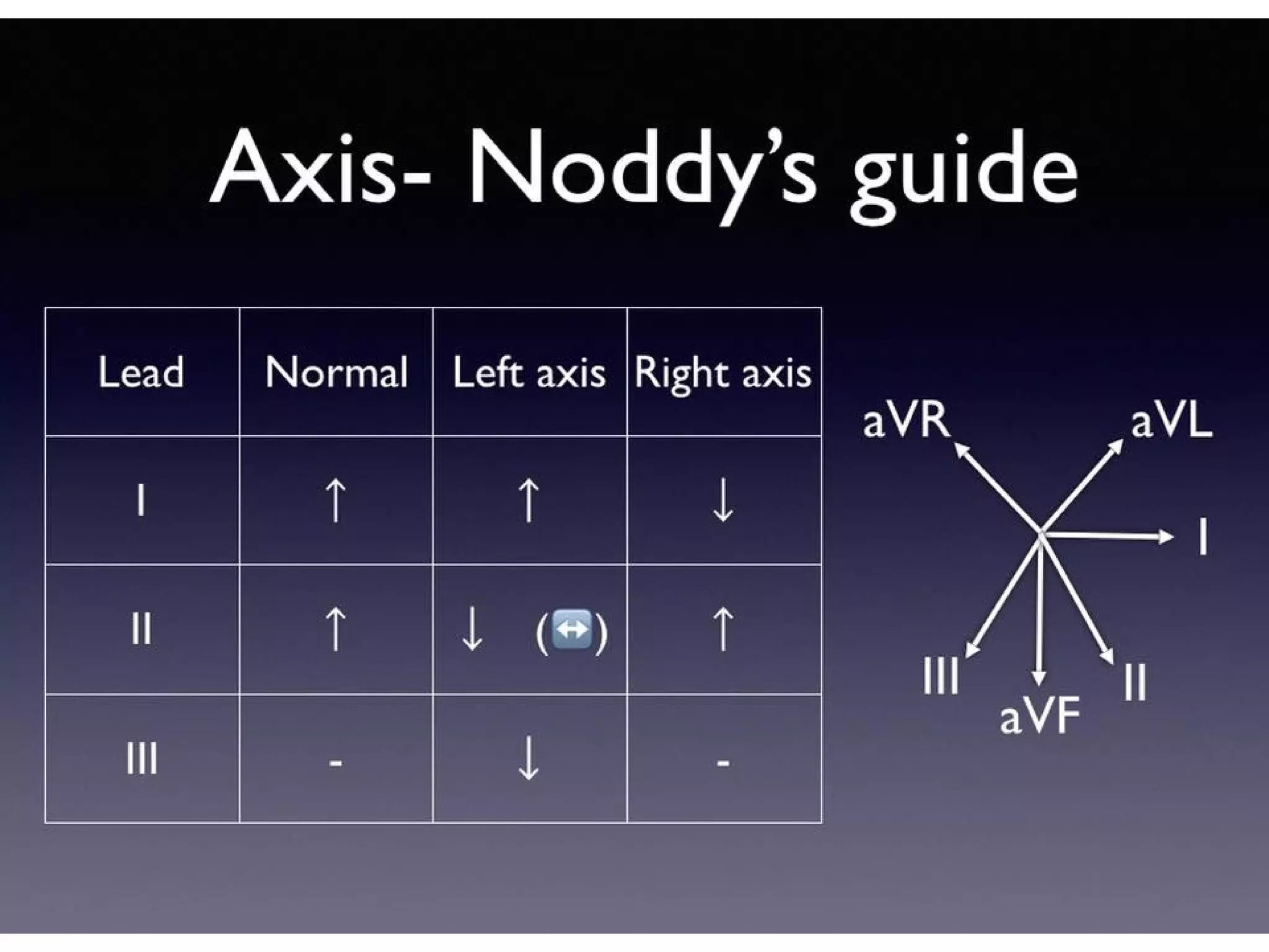 Ventricular activation | PPT
