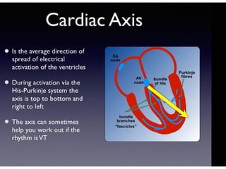 Ventricular activation | PPT