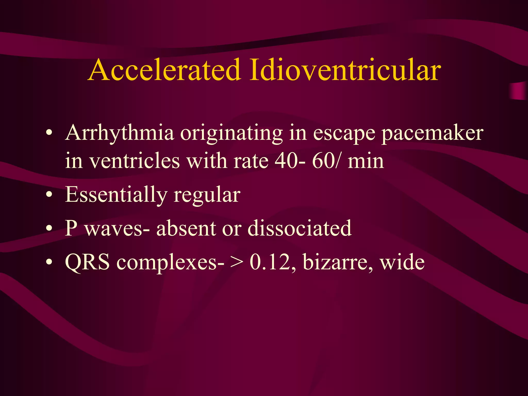 Ventricular and paced arrhythmias | PPTX